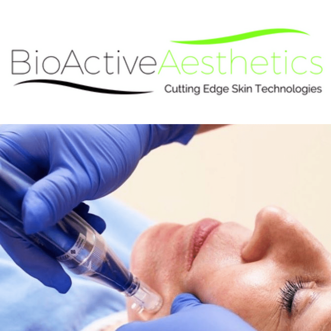 Micro Needling - SkinPen Bromsgrove - NR Aesthetics & Skin